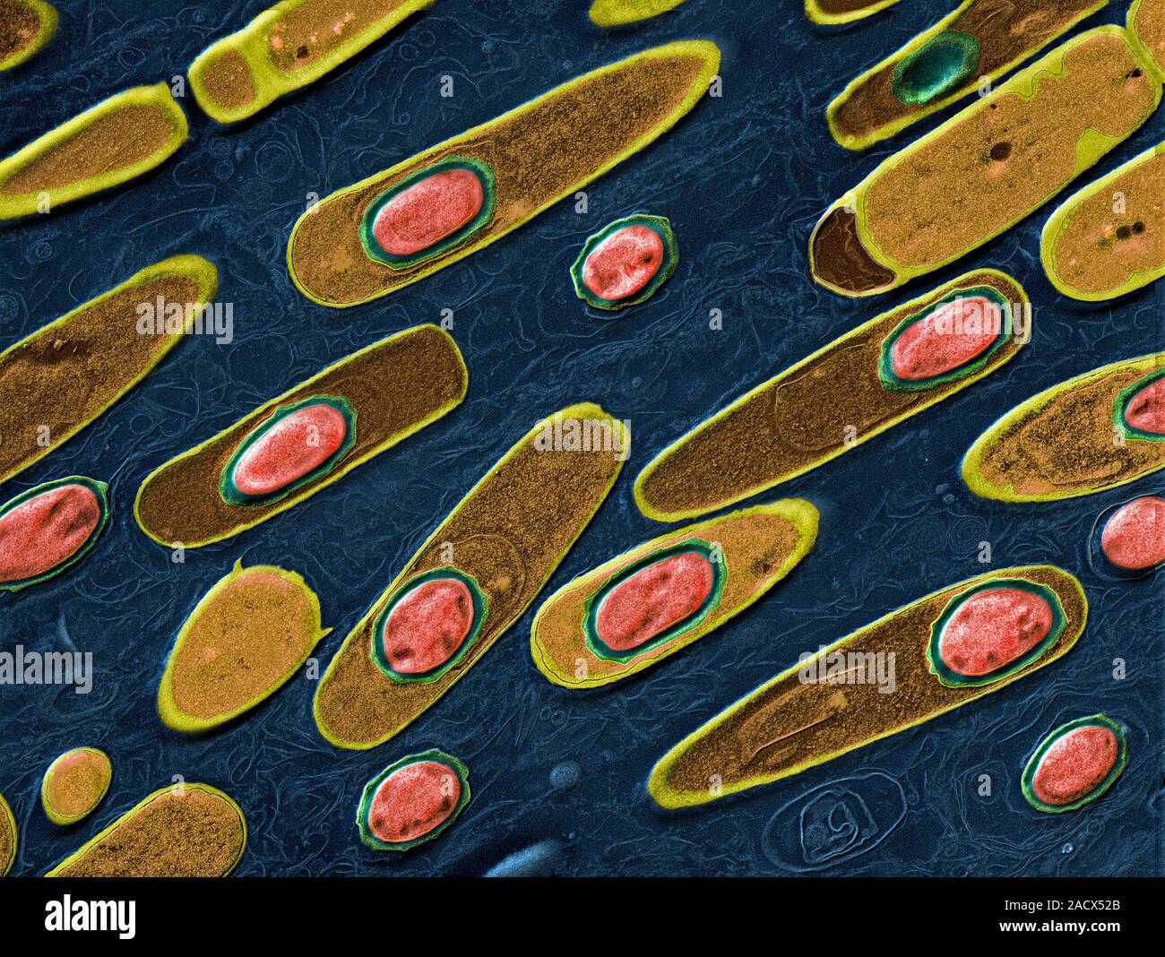 Anthrax bacteria. Coloured transmission electron micrograph (TEM) of ...