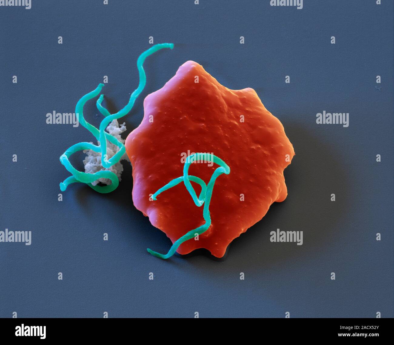 Lyme disease bacteria. Coloured scanning electron micrograph (SEM) of ...