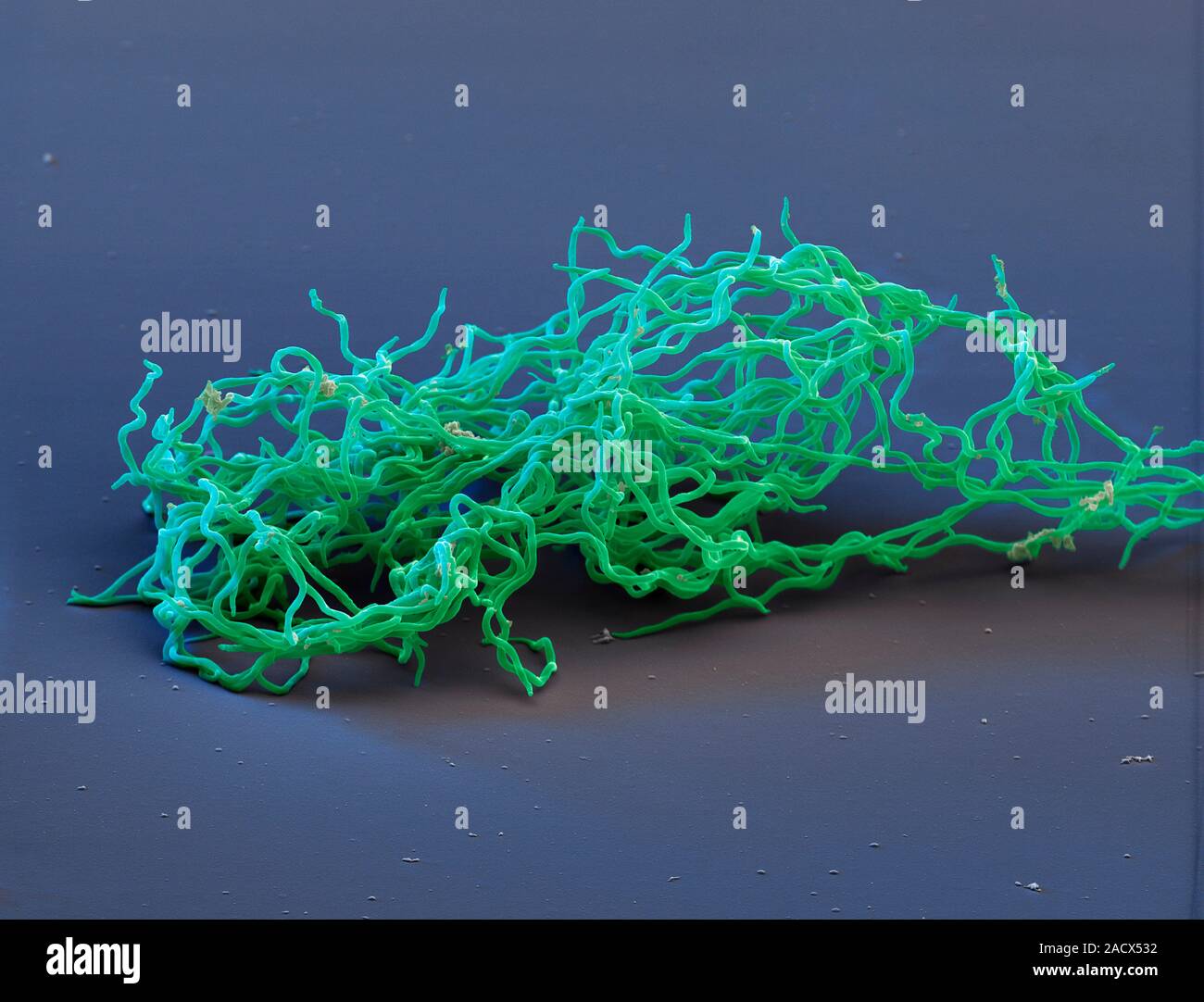 Lyme disease bacteria. Coloured scanning electron micrograph (SEM) of ...