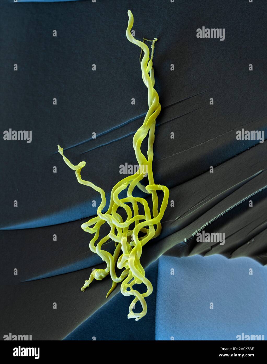Lyme Disease Bacteria Coloured Scanning Electron Micrograph Sem Of