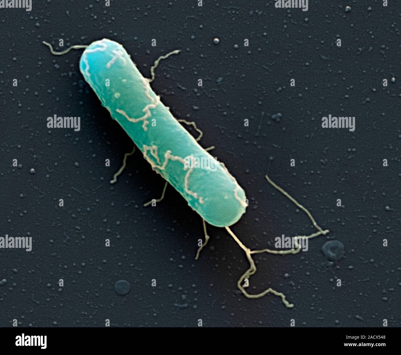 Clostridium botulinum bacterium. Coloured scanning electron micrograph ...