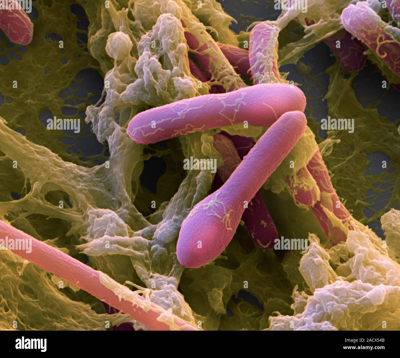 Clostridium botulinum bacteria. Coloured scanning electron micrograph ...
