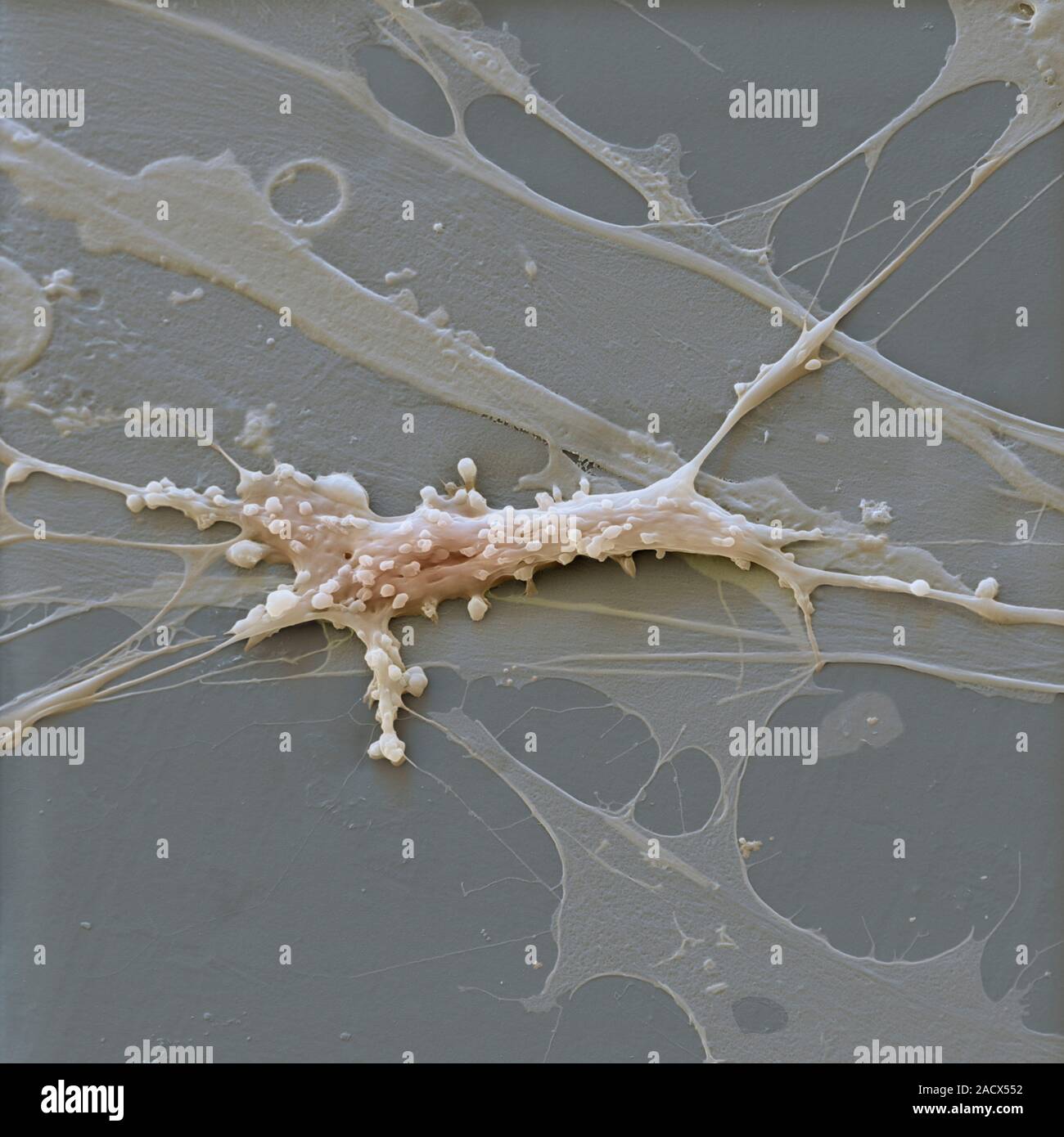 Fibroblast cells, coloured scanning electron micrograph (SEM ...