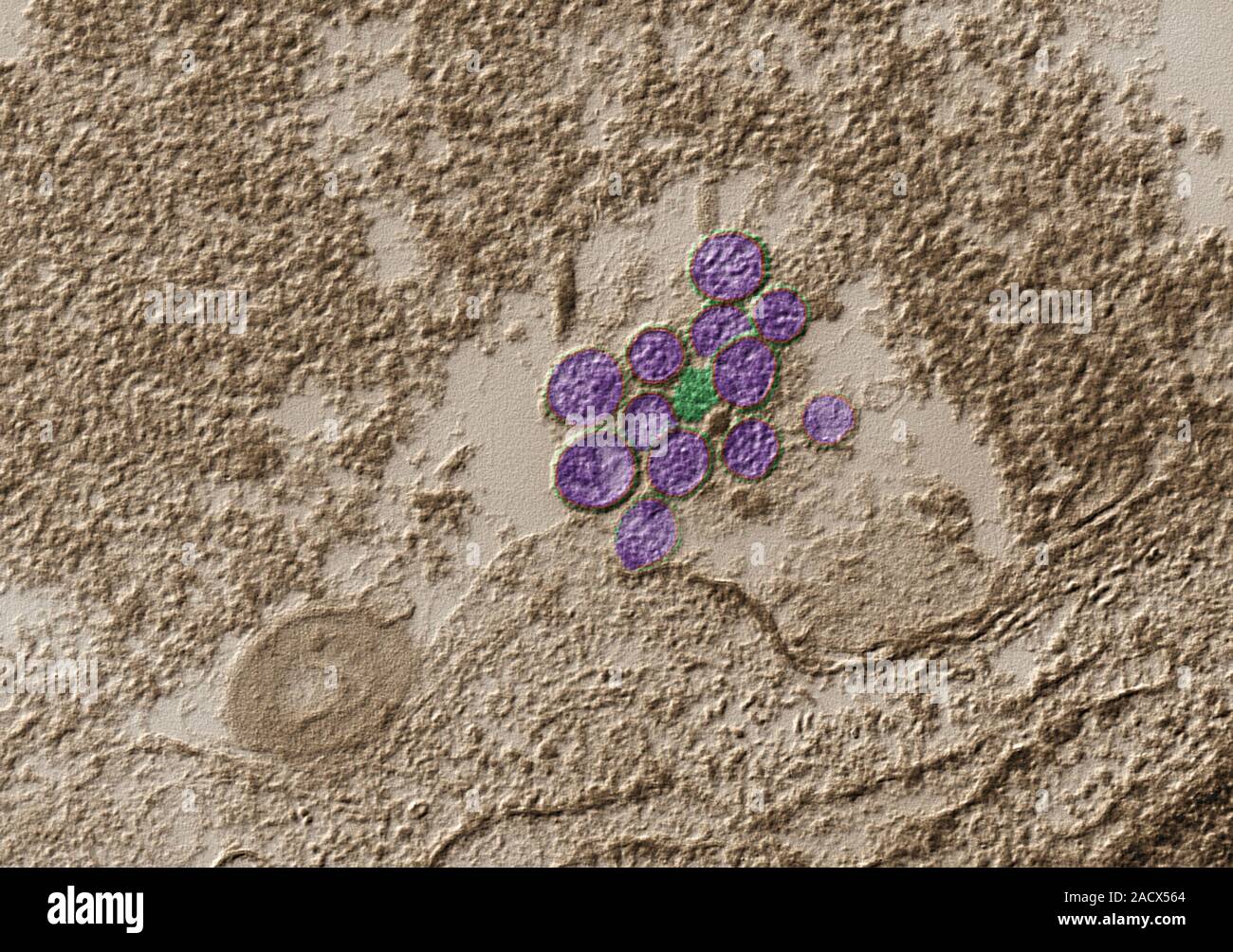 Hantavirus particles, coloured transmission electron micrograph (TEM ...