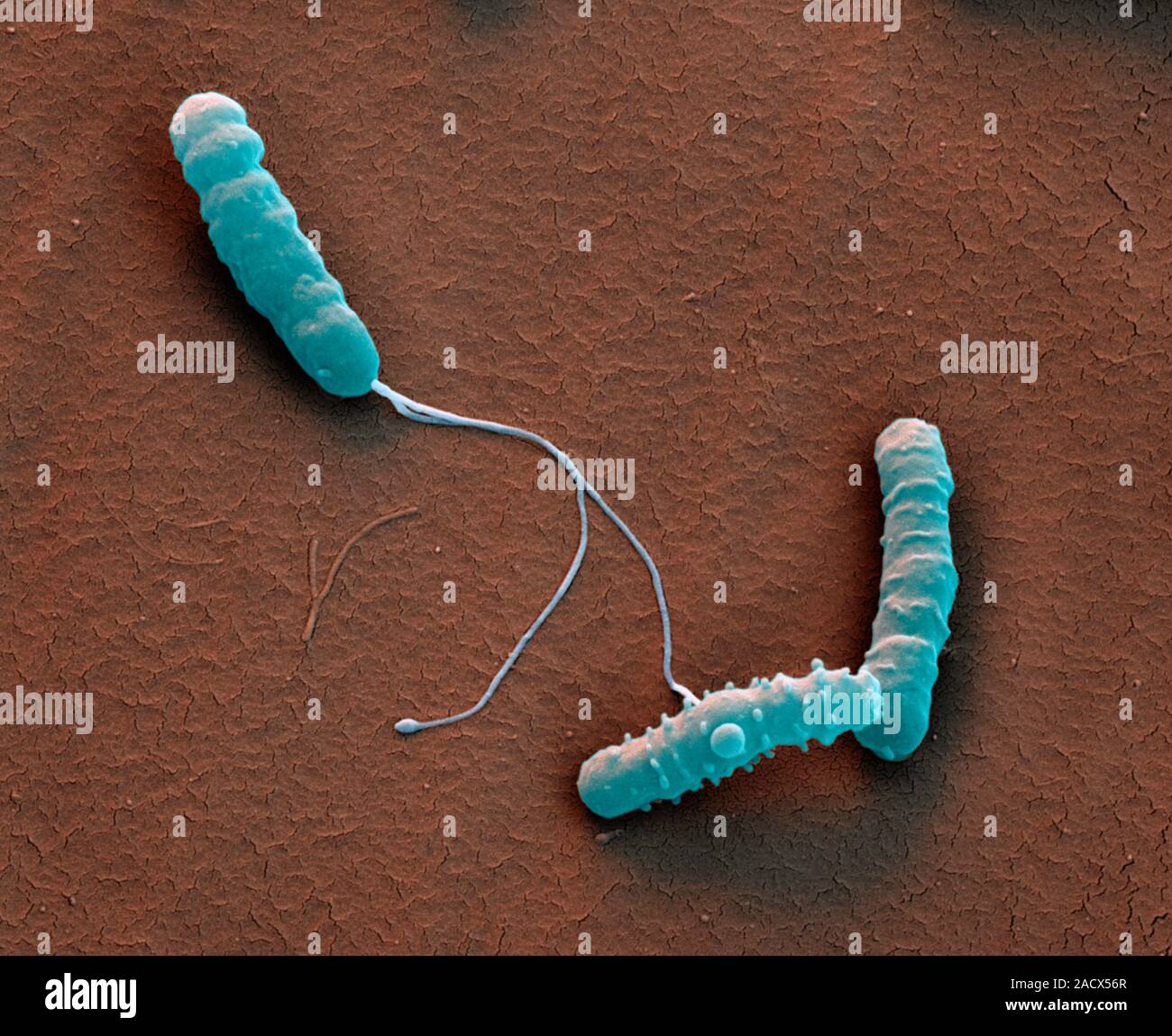 Helicobacter pylori bacteria, coloured scanning electron micrograph (SEM). H. pylori is a Gram ...