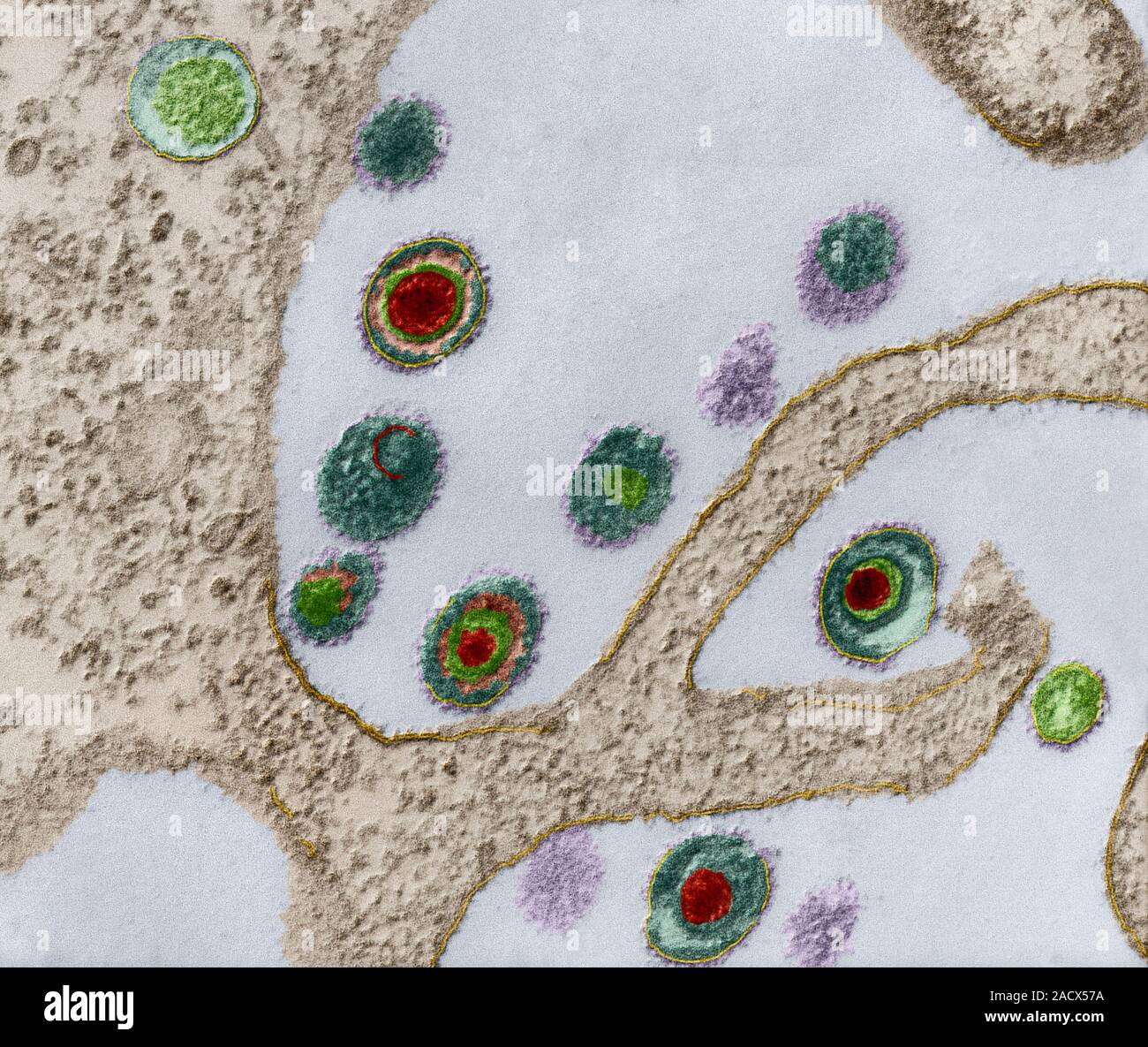 Herpes particles. Coloured transmission electron micrograph (TEM) of ...