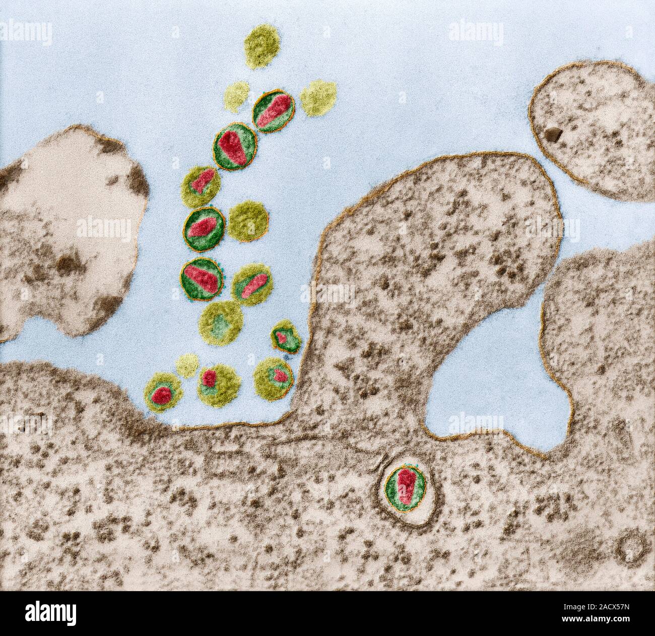 Herpes particles. Coloured transmission electron micrograph (TEM) of ...