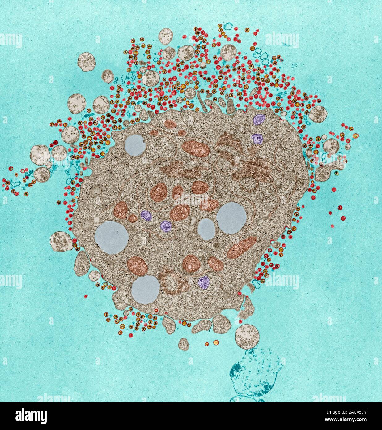 HIV infected cell. Coloured transmission electron micrograph (TEM) of ...