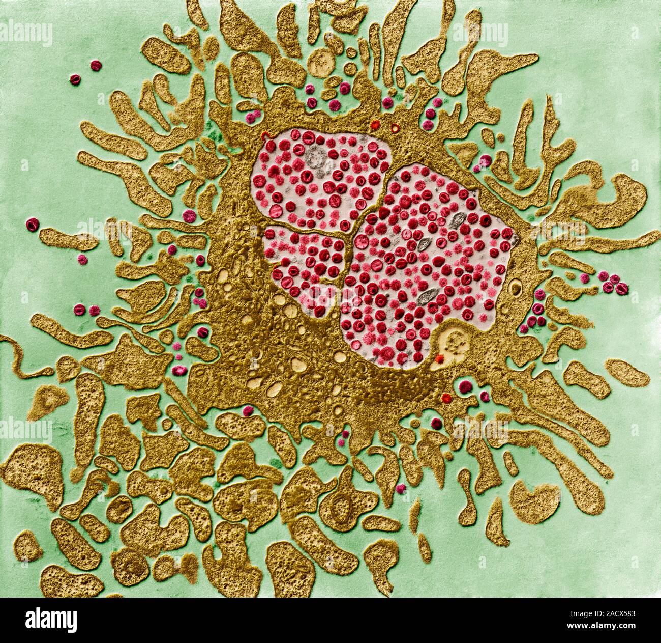 HIV infected cell. Coloured transmission electron micrograph (TEM) of ...