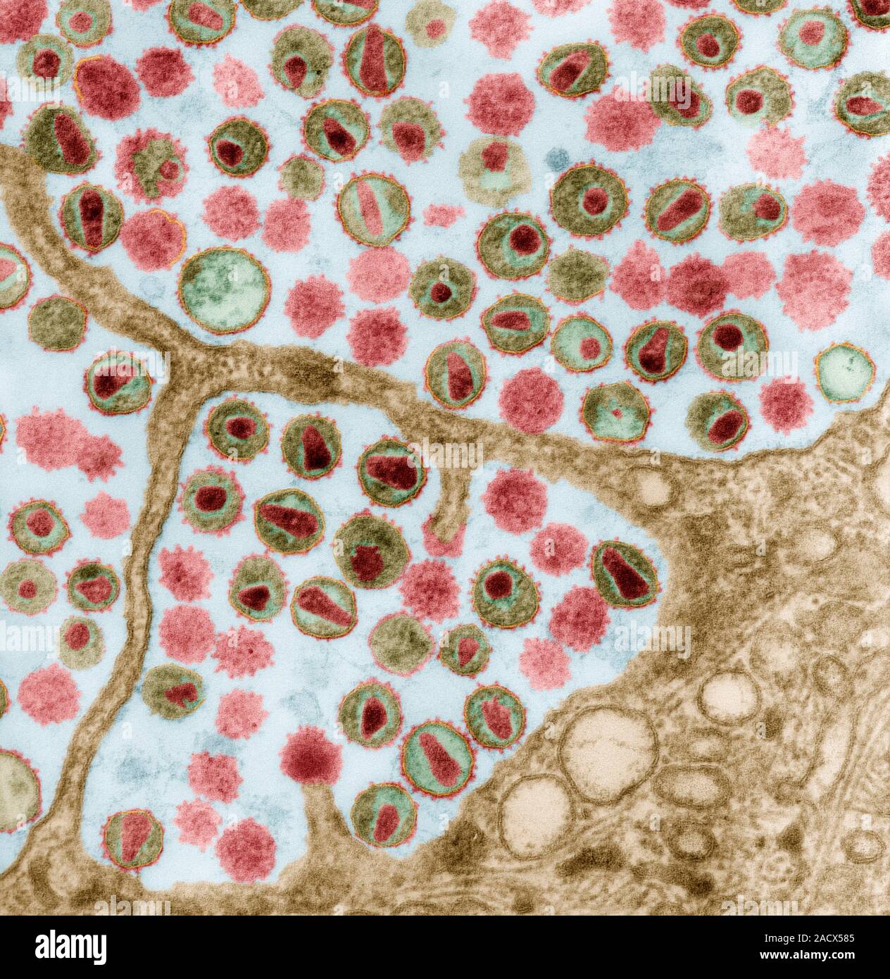 Hiv Infected Cell Coloured Transmission Electron Micrograph Tem Of Human Immunodeficiency