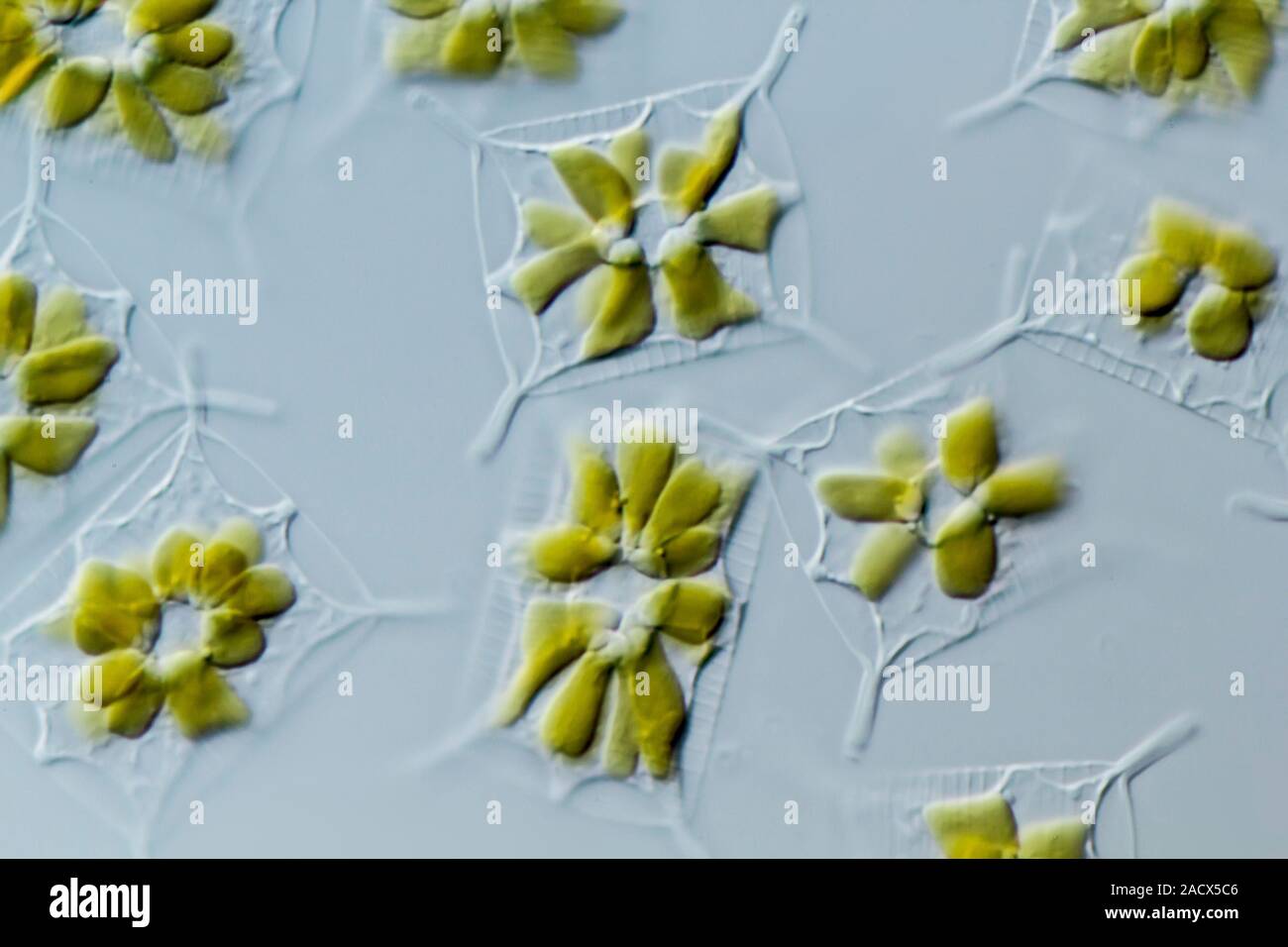 Light micrograph of Attheya sp., a marine diatom. Culture material of ...