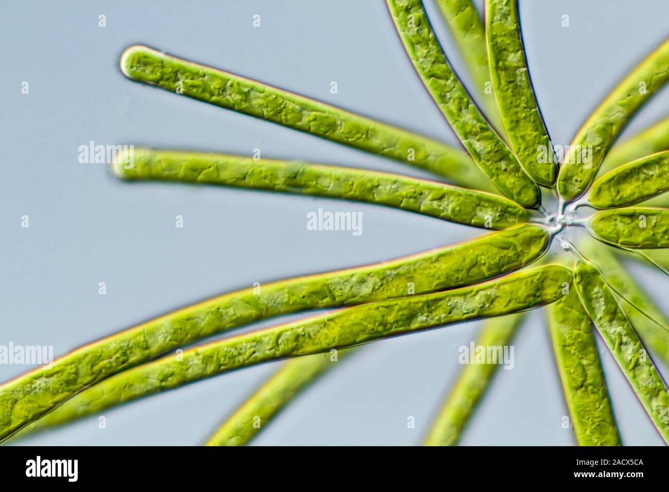 Light micrograph of Ophiocytium sp., a freshwater heterokont alga ...