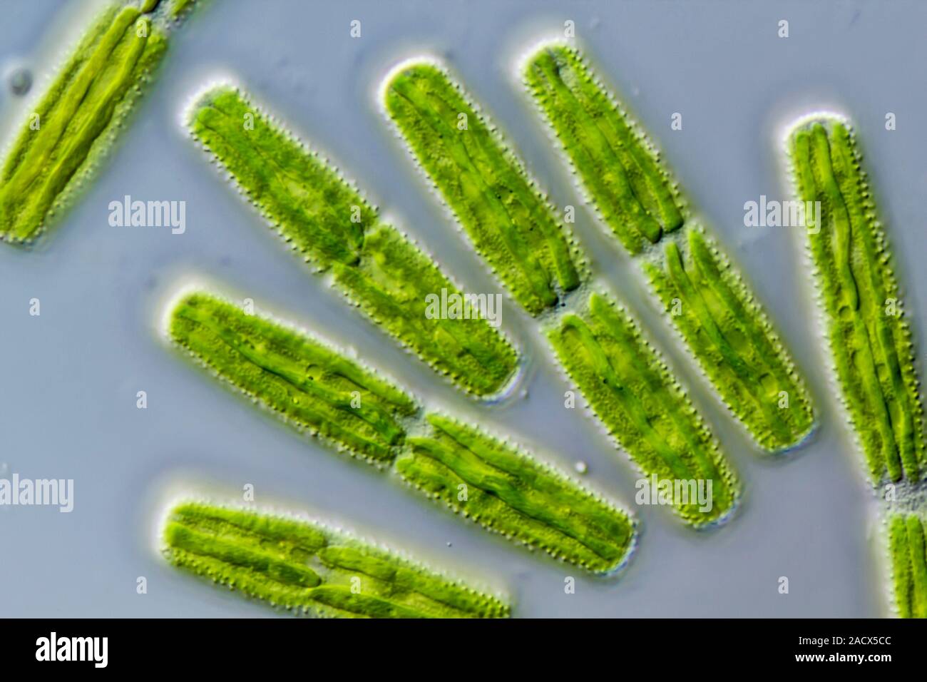 Light micrograph of Penium exiguum, a freshwater green alga. Culture ...
