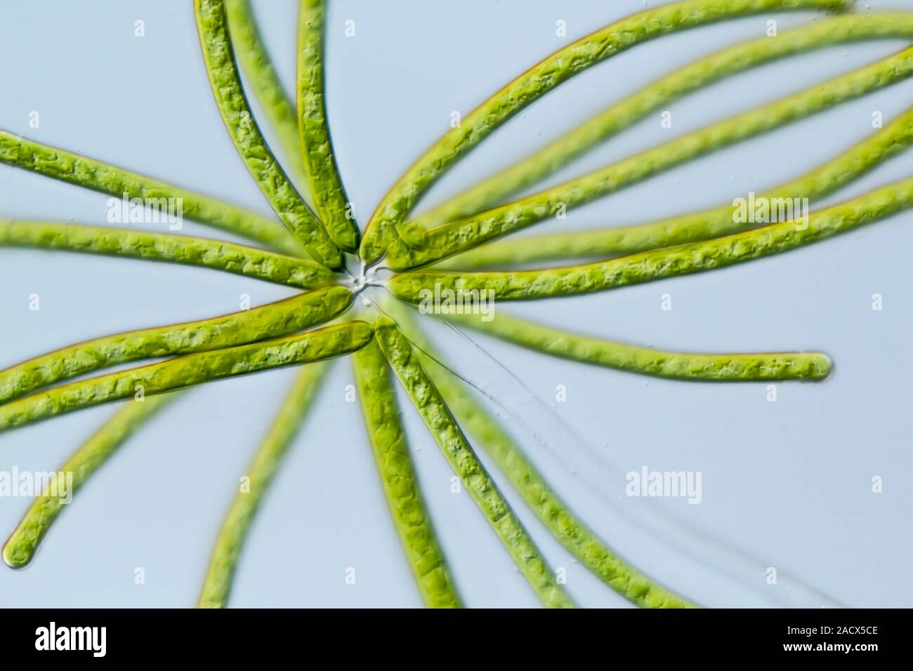 Light micrograph of Ophiocytium sp., a freshwater heterokont alga ...