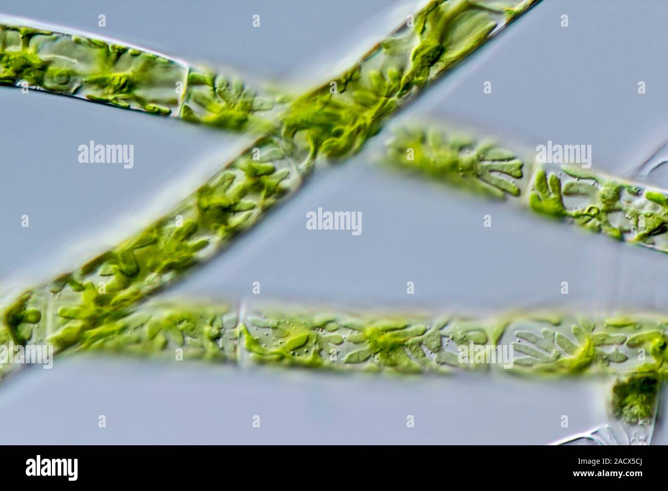 Light micrograph of Zygnema pseudogedeanum, a freshwater filamentous ...