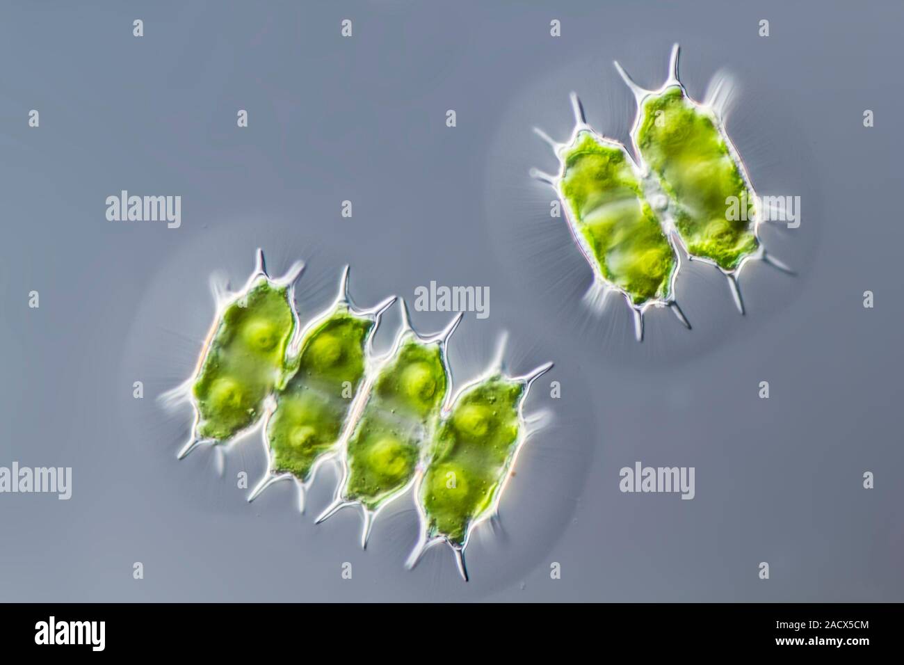 Light micrograph of Xanthidium antilopaeum, a freshwater green alga ...