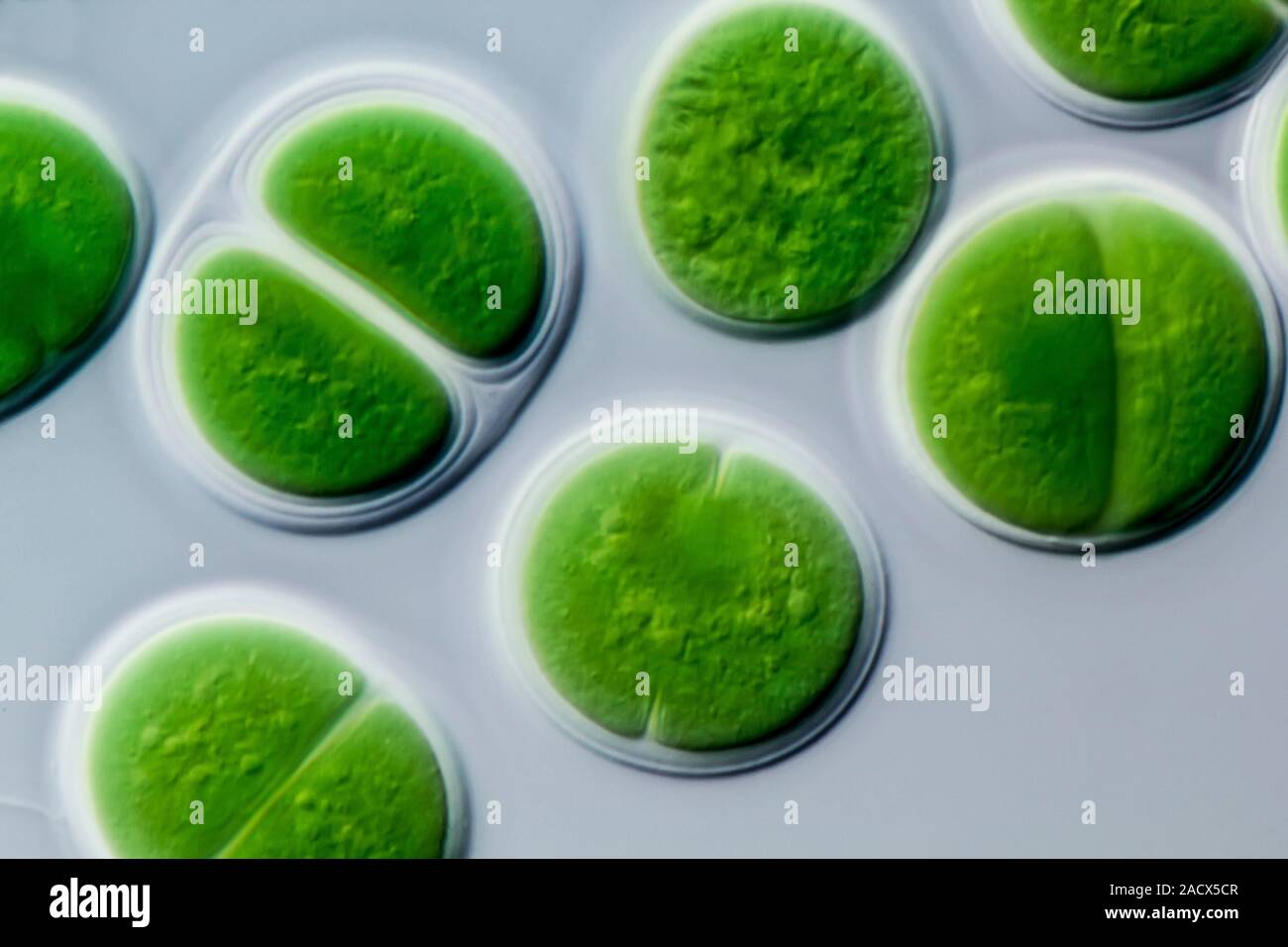 Light micrograph of Chroococcus turgidus, a marine cyanobacterium ...