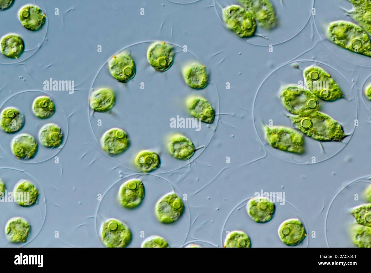 Light micrograph of Stephanosphaera sp., a freshwater green alga ...
