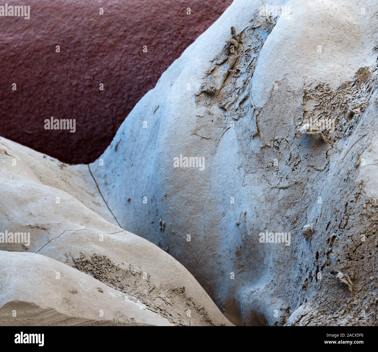 Sealed fissure in tooth. Coloured scanning electron micrograph (SEM) of ...