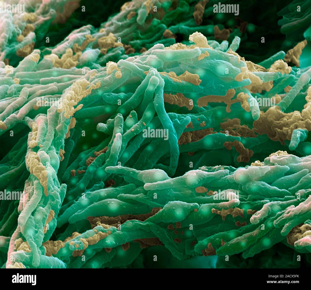 Tuberculosis bacteria. Coloured scanning electron micrograph of ...