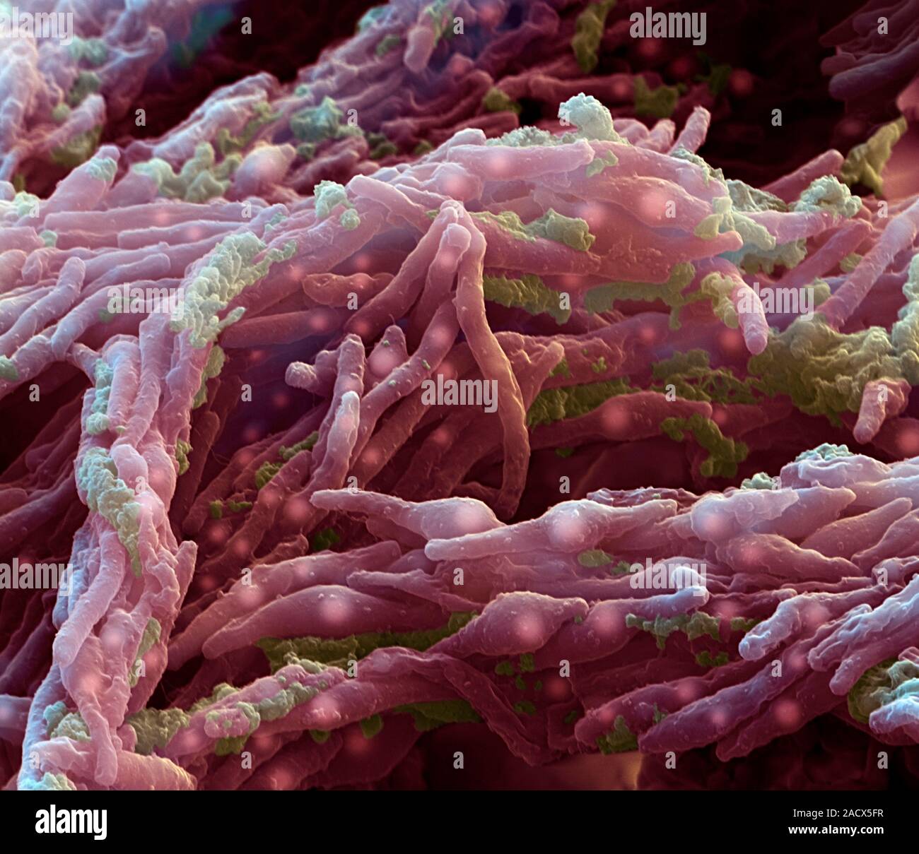 Tuberculosis bacteria. Coloured scanning electron micrograph (SEM) of ... Tuberculosis bacteria. Coloured scanning electron micrograph (SEM) of ...