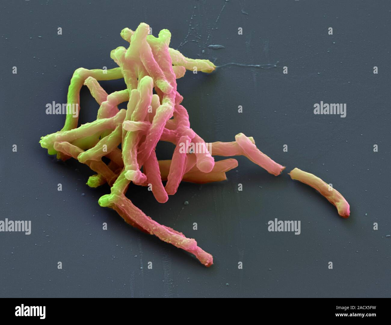 Tuberculosis bacteria. Coloured scanning electron micrograph of Mycobacterium tuberculosis ...