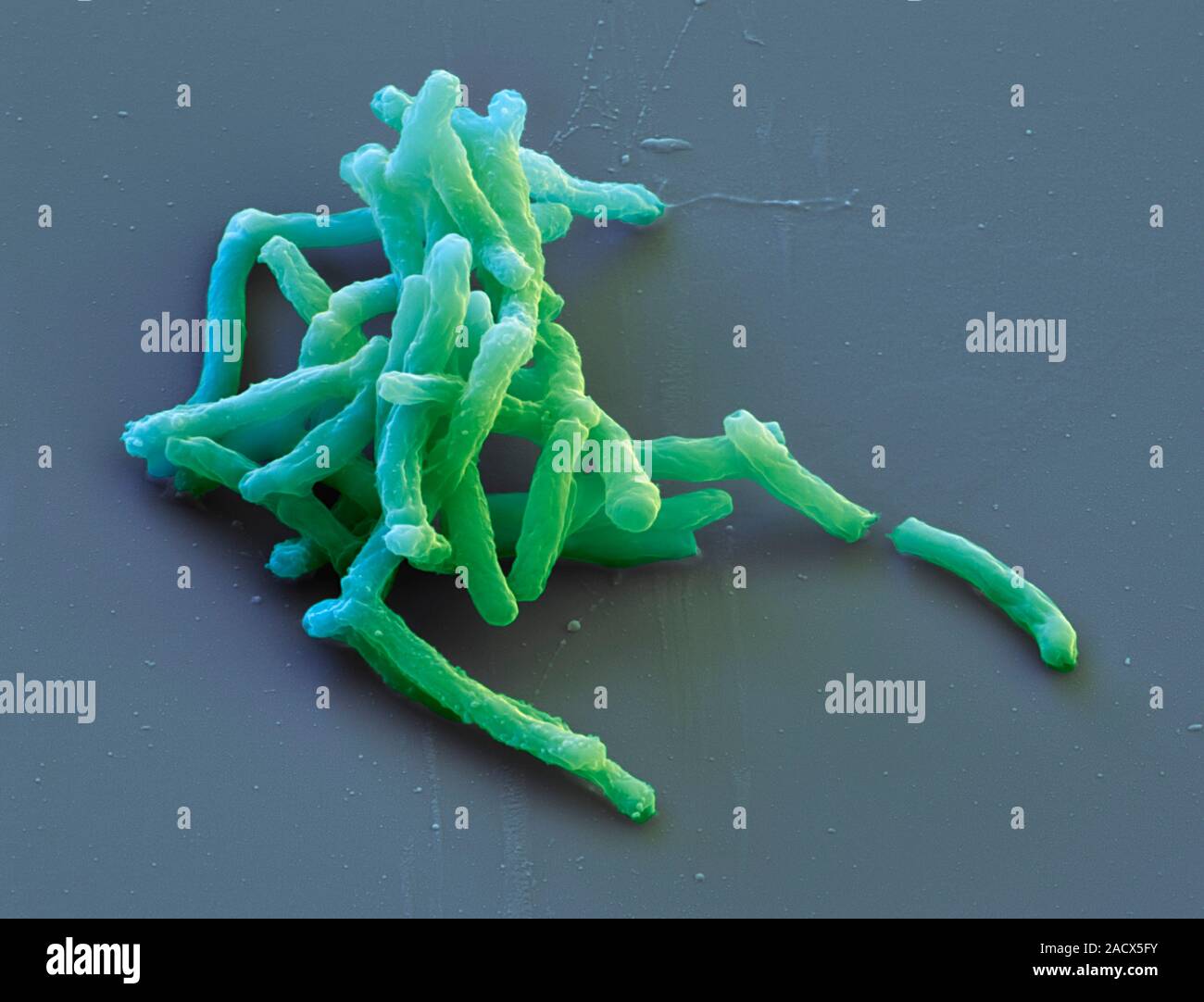 Tuberculosis bacteria. Coloured scanning electron micrograph of Mycobacterium tuberculosis ...