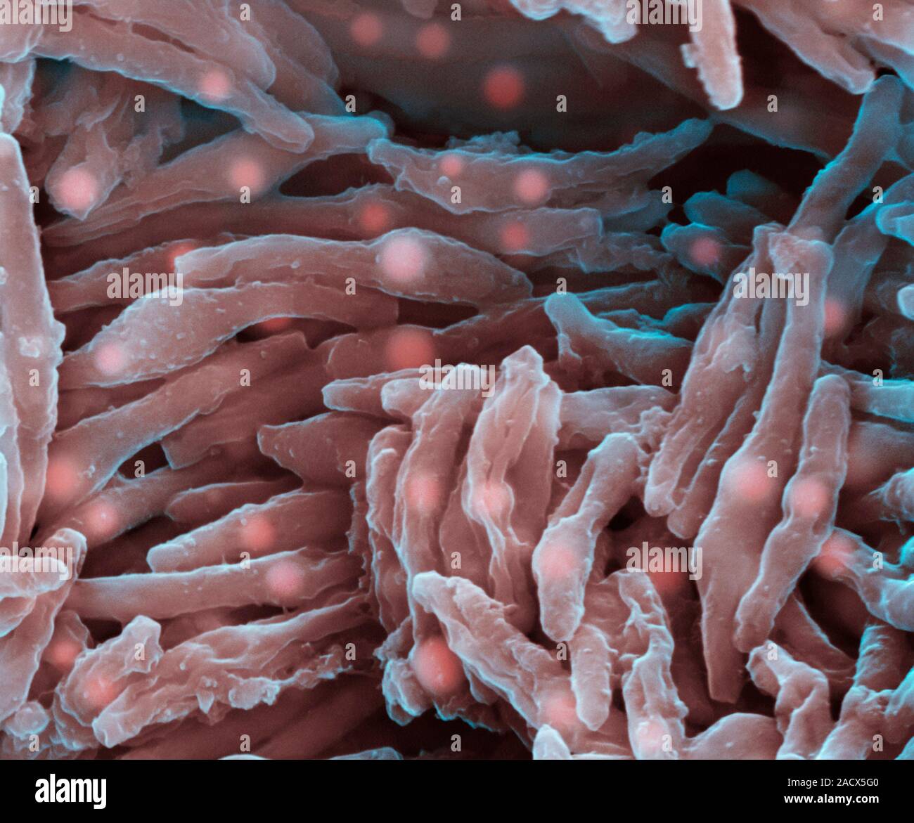Tuberculosis bacteria. Coloured scanning electron micrograph of Mycobacterium tuberculosis ...