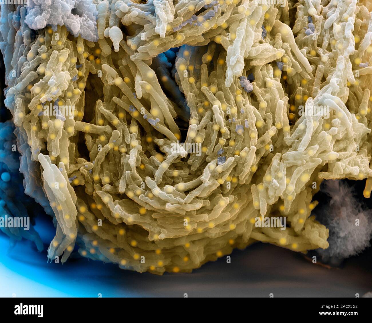 Tuberculosis bacteria. Coloured scanning electron micrograph of ... Tuberculosis bacteria. Coloured scanning electron micrograph of ...
