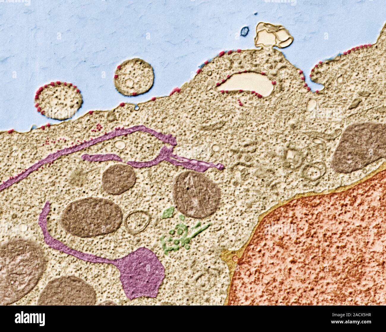 Measles virus infection. Coloured transmission electron micrograph (TEM ...