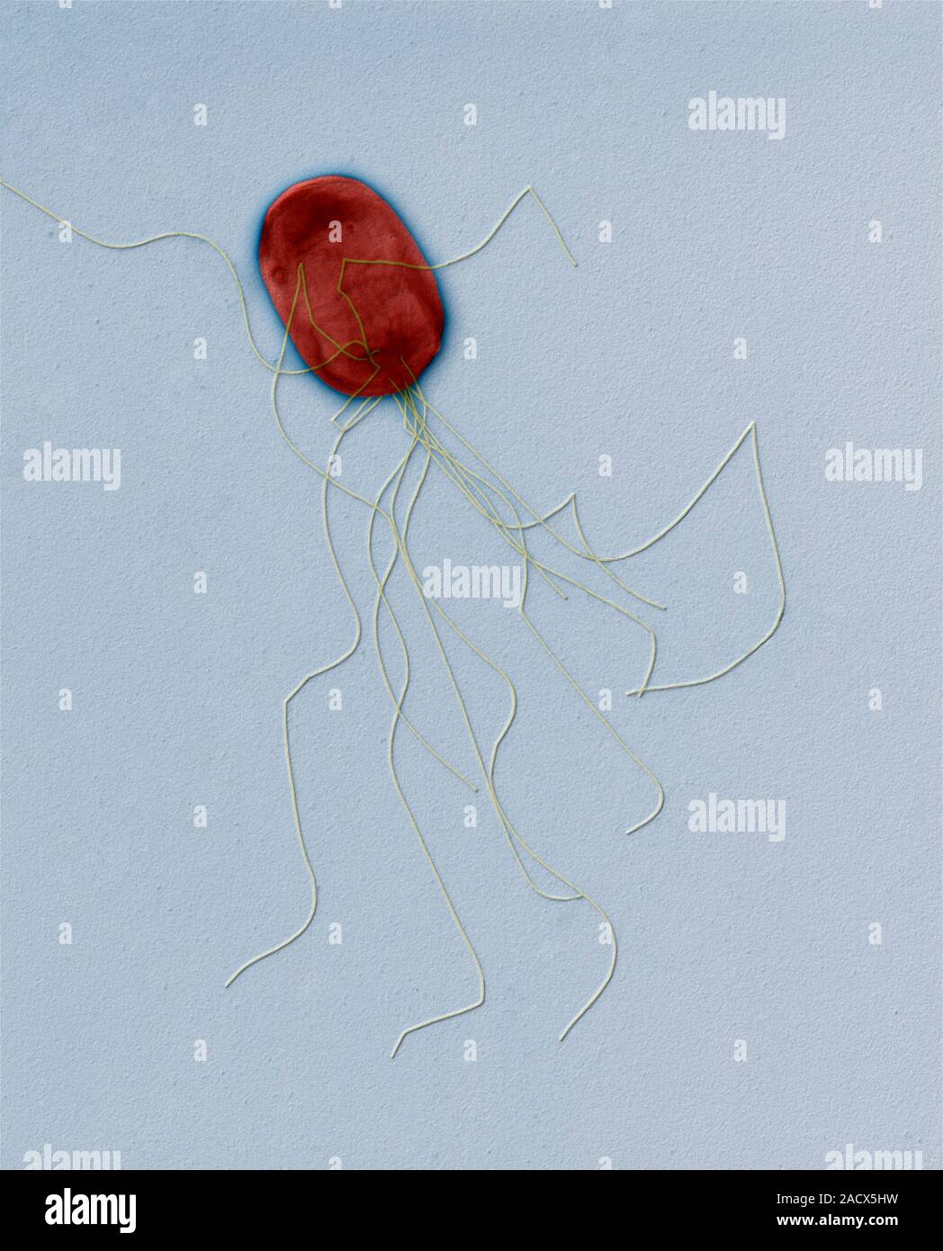 Proteus mirabilis bacterium, scanning electron micrograph (SEM). This ... Proteus mirabilis bacterium, scanning electron micrograph (SEM). This ...
