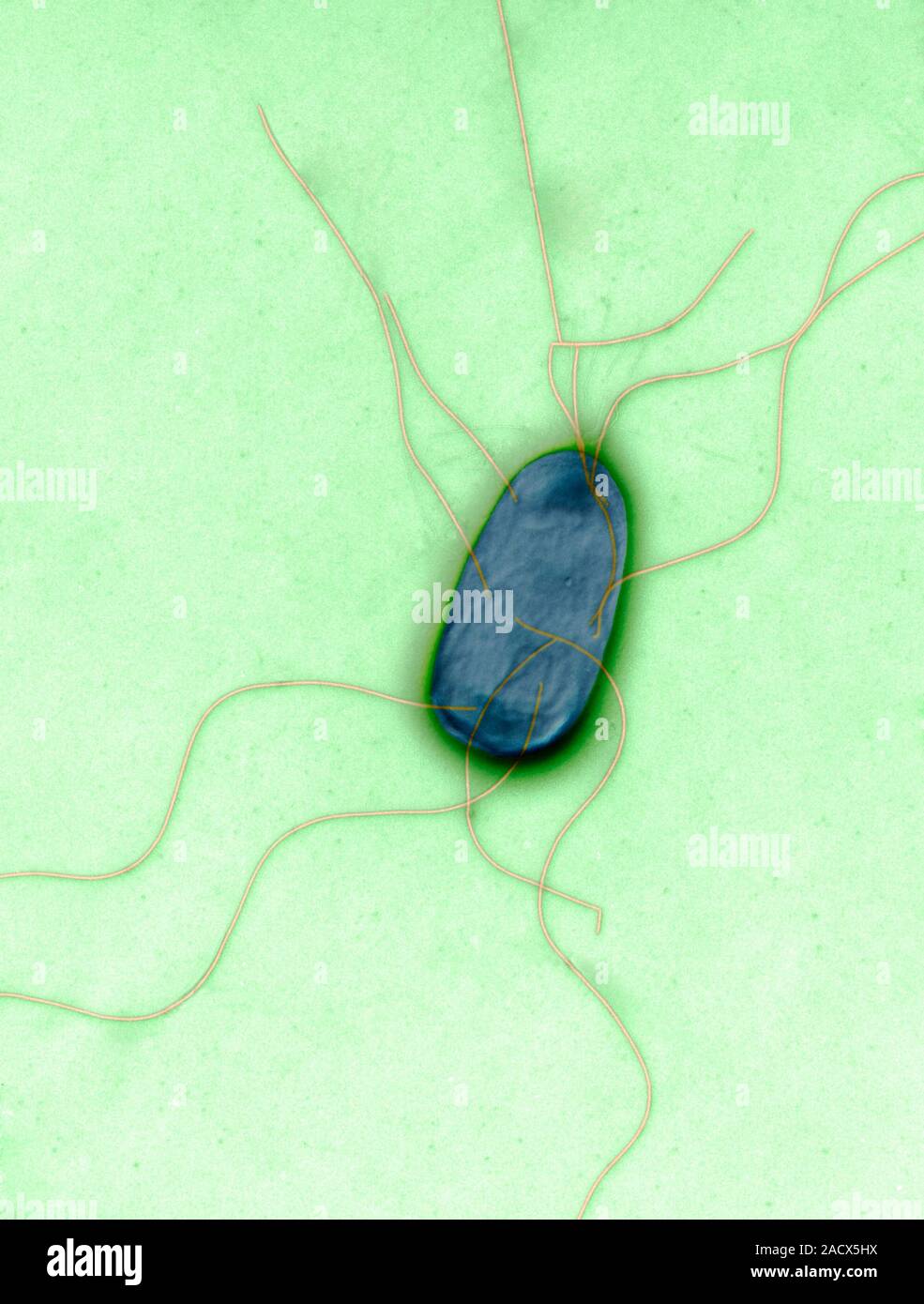 Proteus mirabilis bacterium, scanning electron micrograph (SEM). This ... Proteus mirabilis bacterium, scanning electron micrograph (SEM). This ...