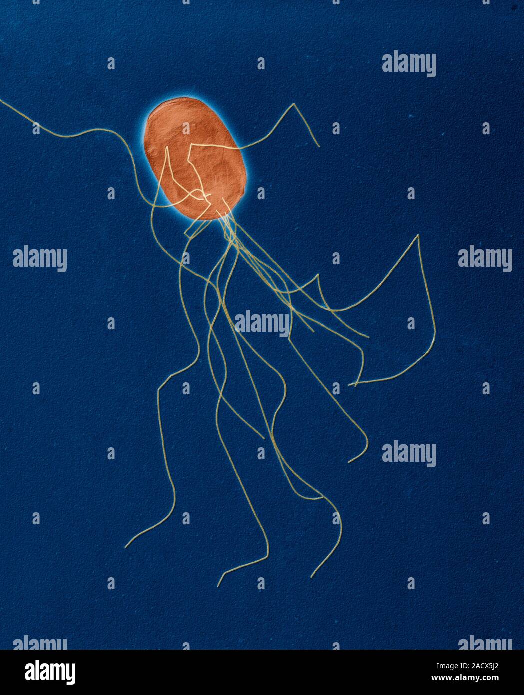 Proteus mirabilis bacterium, scanning electron micrograph (SEM). This ...