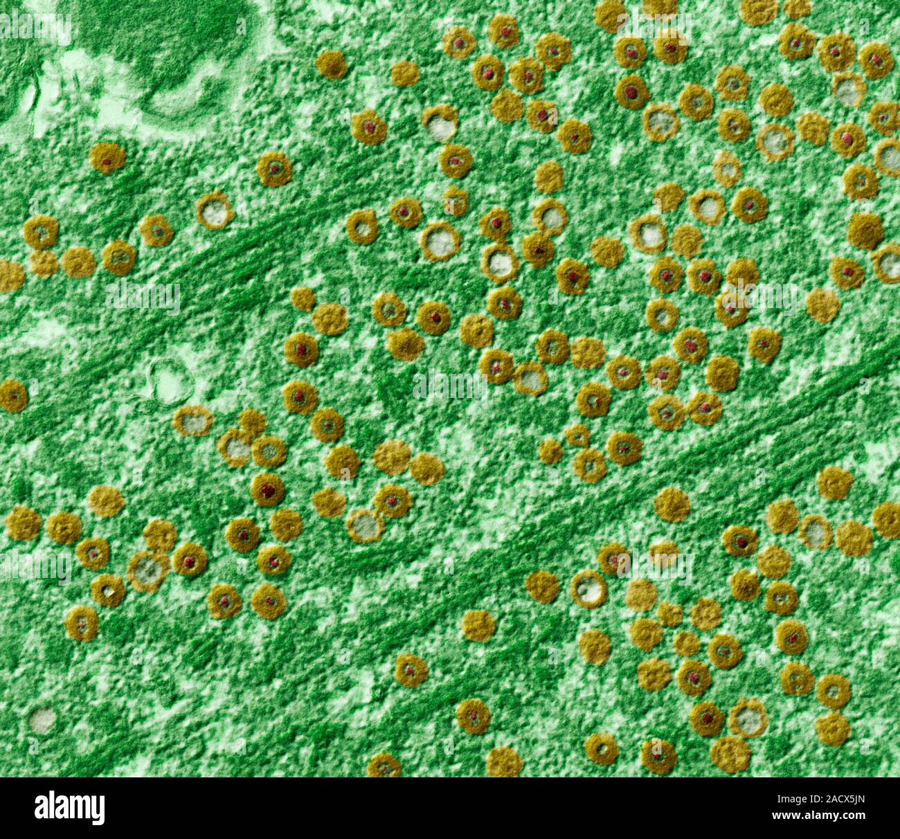 Reovirus infection. Coloured transmission electron micrograph (TEM) of ...