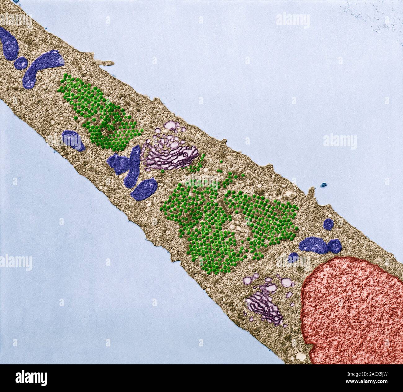 Reovirus infection. Coloured transmission electron micrograph (TEM) of ...