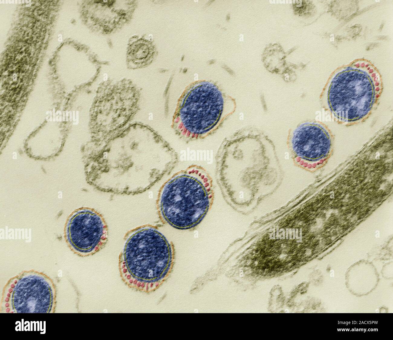 Spirochete bacteria, coloured transmission electron micrograph (TEM ...
