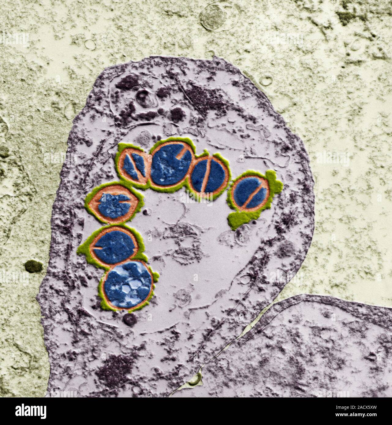 Streptococcus in lung tissue. Coloured transmission electron micrograph ...