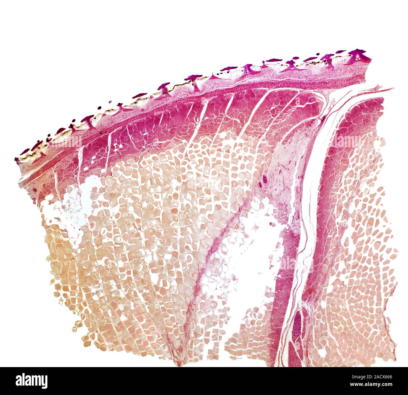 Dogfish skin. Light micrograph of a section through the skin of a ...