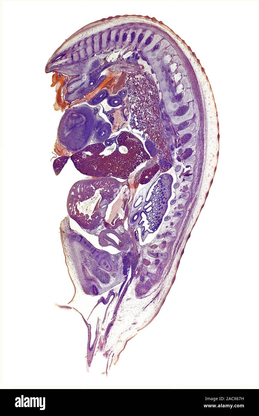 Chicken embryo. Light micrograph of a chicken (Gallus domesticus ...