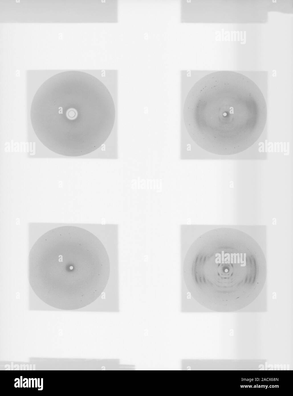 DNA research. X-ray crystallography diffraction patterns obtained in ...