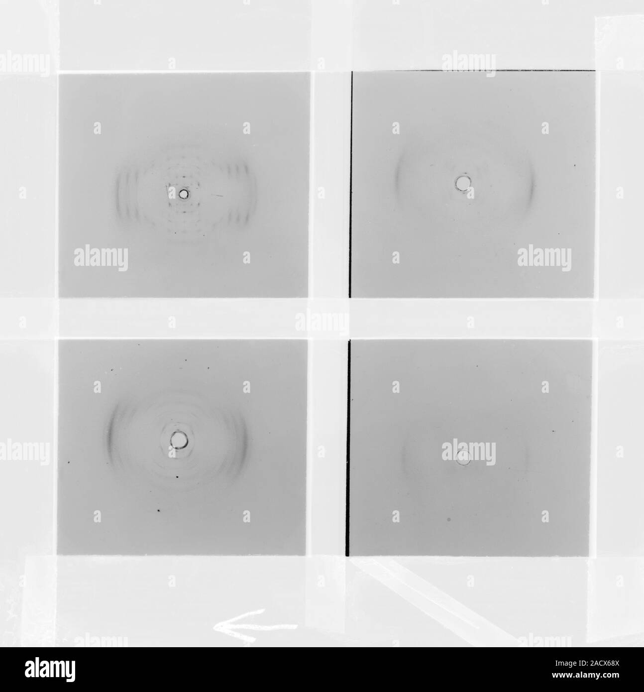 DNA research. X-ray crystallography diffraction patterns obtained in ...