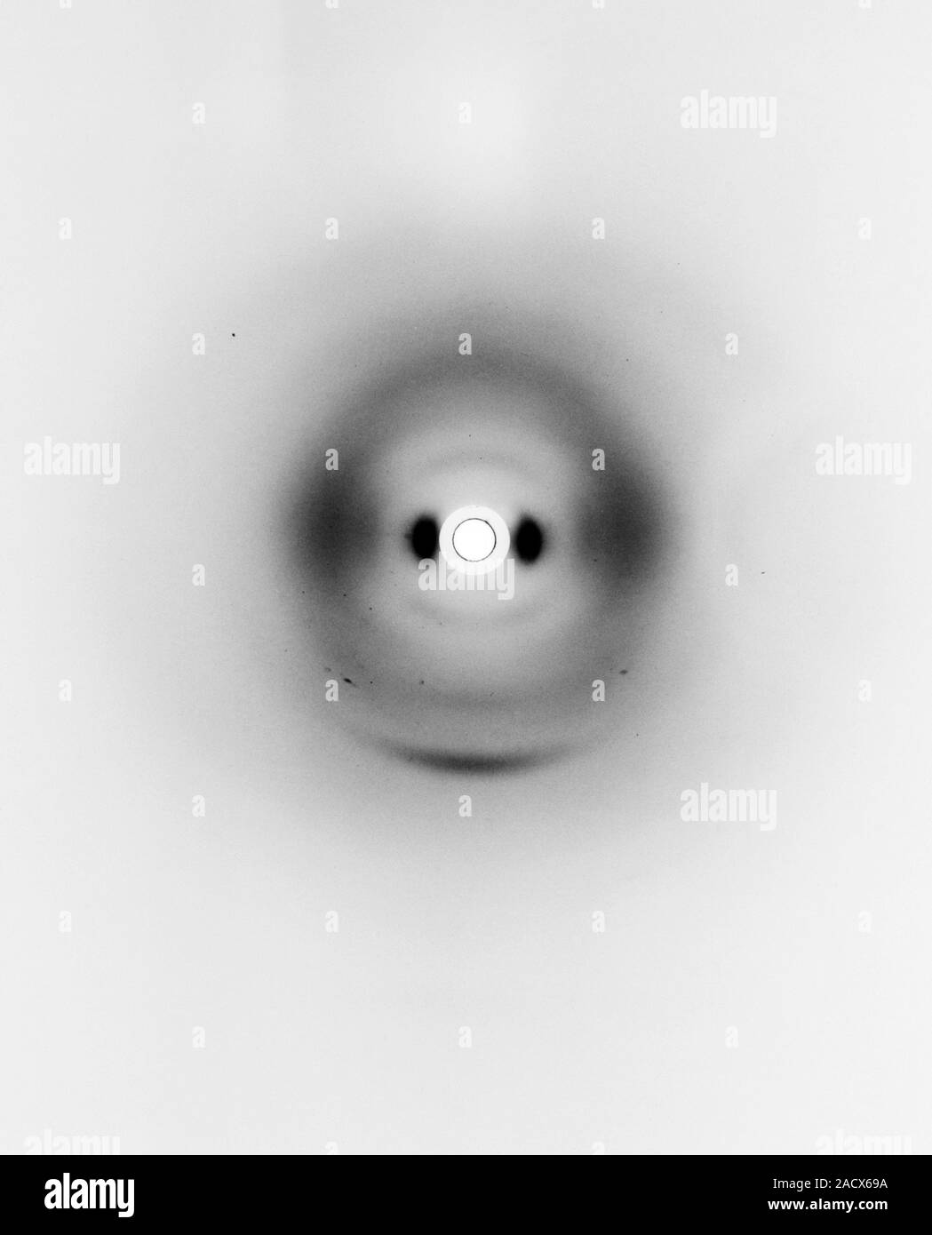 Collagen structure. X-ray crystallography diffraction pattern obtained ...