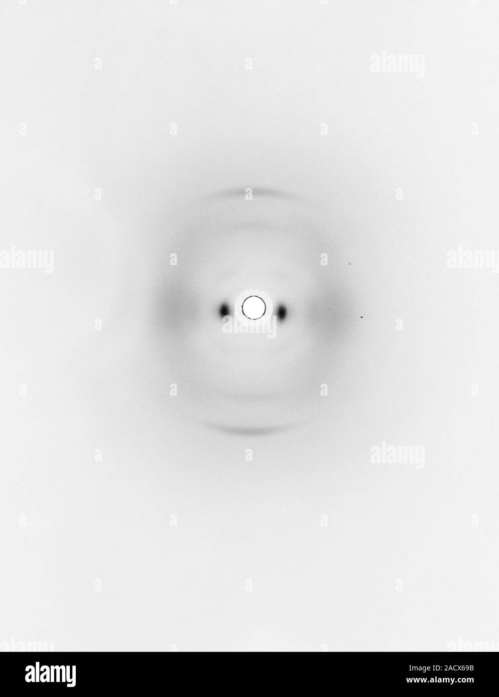 Collagen structure. X-ray crystallography diffraction pattern obtained ...