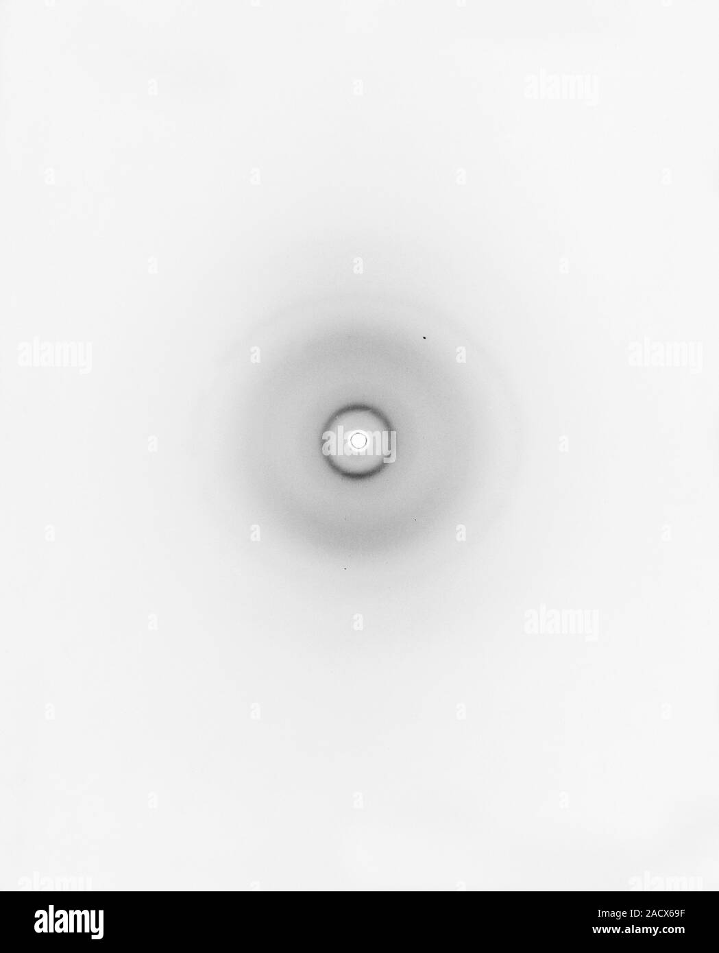 Procollagen structure. X-ray crystallography diffraction powder pattern ...