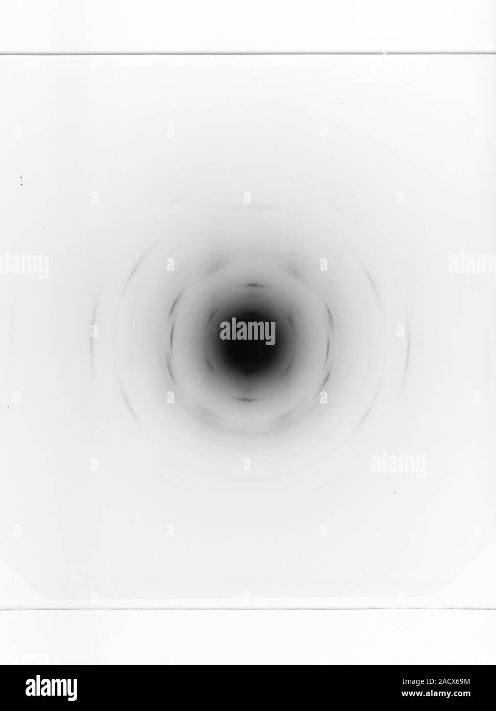 Procollagen structure. X-ray crystallography diffraction pattern ...