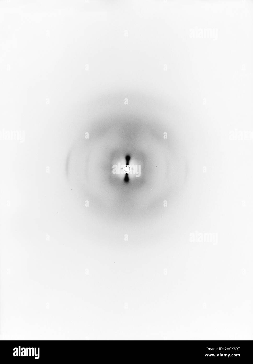 Tendon research. X-ray crystallography diffraction pattern obtained as ...