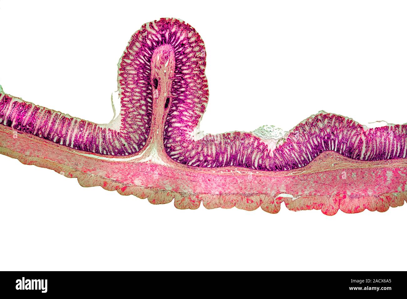 Cat colon. Light micrograph of a section through the colon, part of the ...