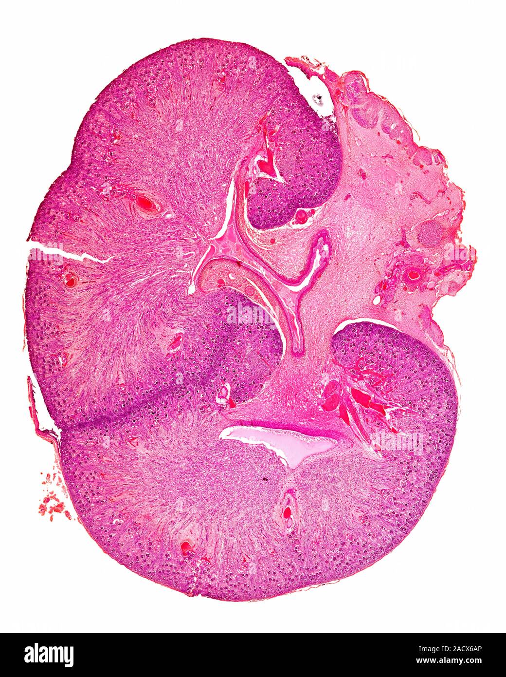 Foetal kidney. Light micrograph of a longitudinal section through a ...