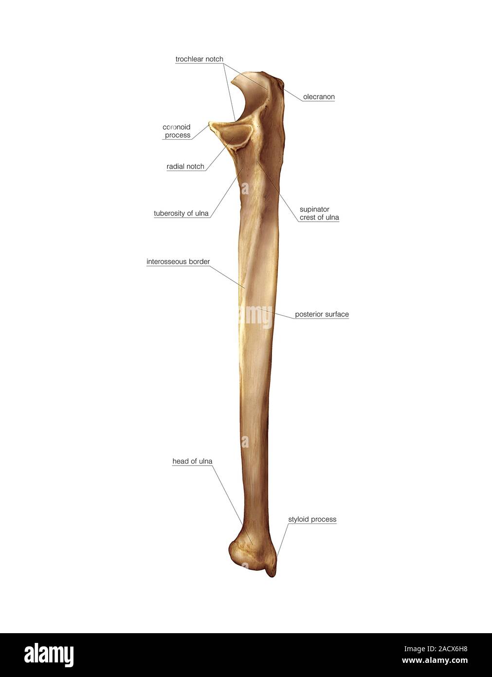 Illustration of the ulna bone. This radial view labelled illustration ...