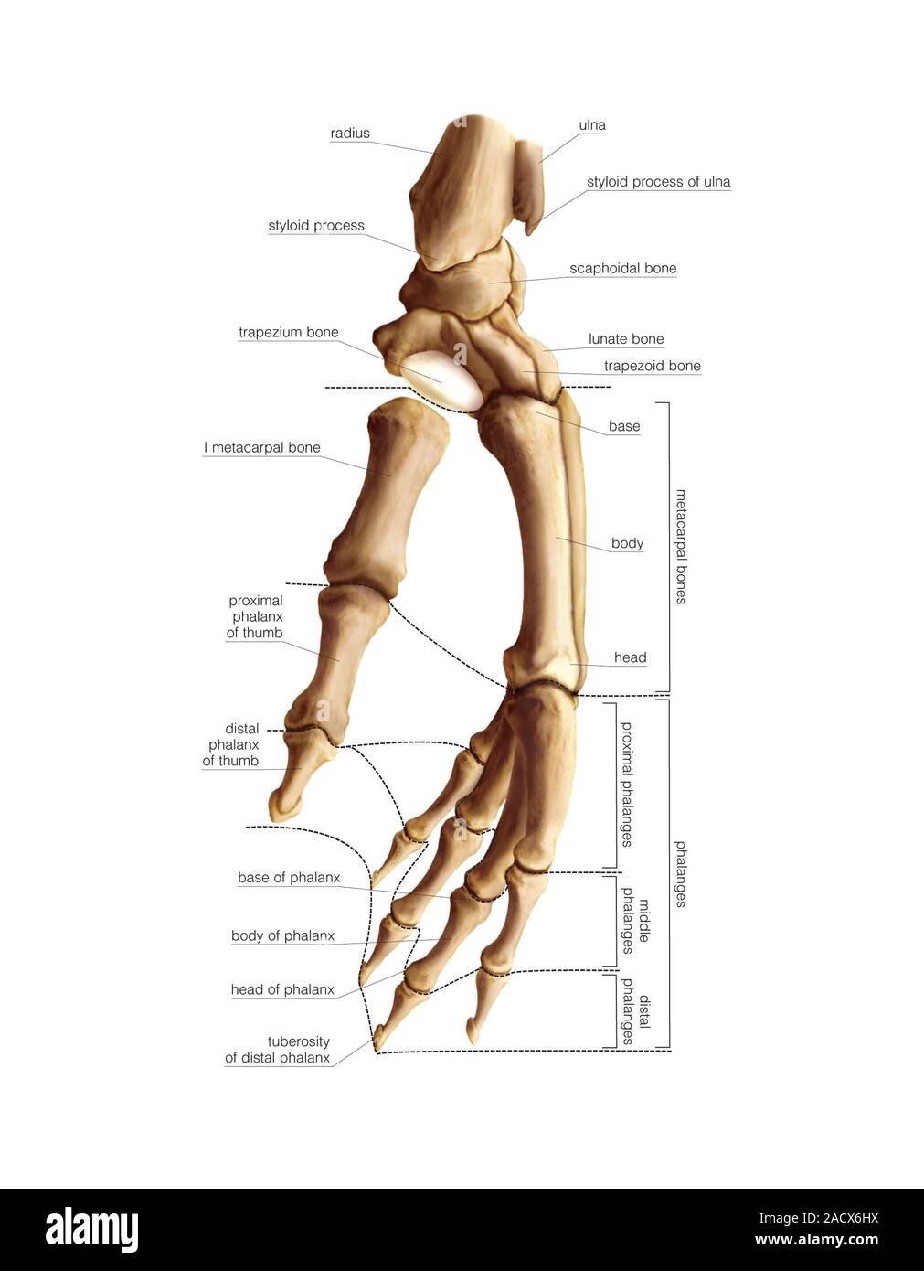 Illustration of the bones of wrist and metacarpus. This left hand ...